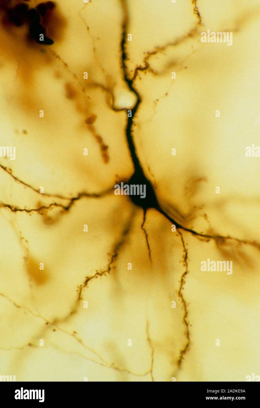 Light micrograph of a pyramidal neuron (nerve cell) from mammalian ...
