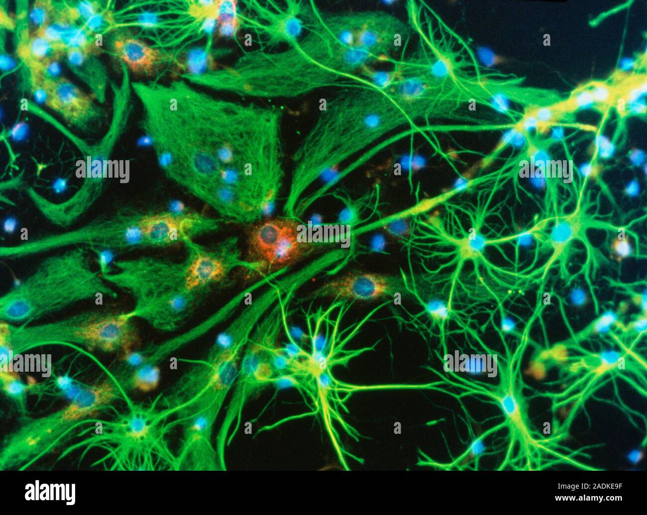 Immunofluorescent Light Micrograph of astrocytes, with other neuroglial ...