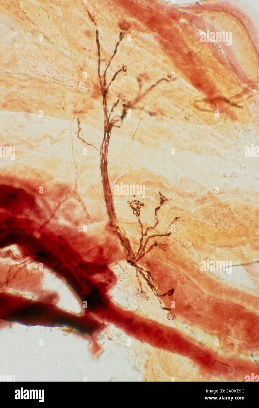 Nerve-muscle connection. Light micrograph of neuromuscular synapses ...