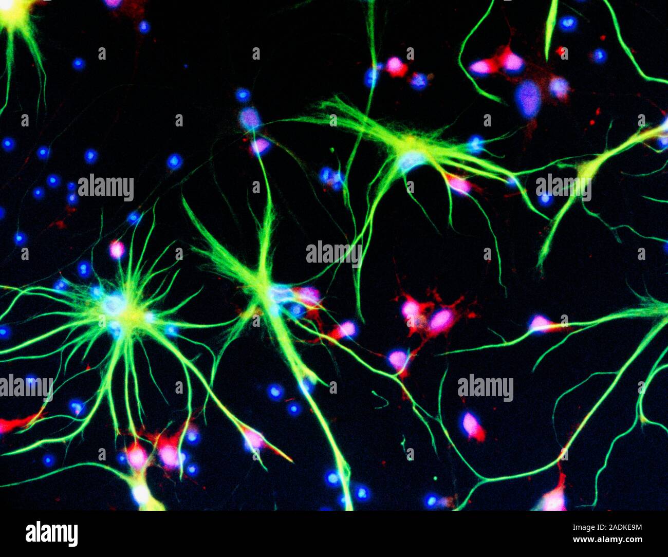 Immunofluorescent Light Micrograph of neuron cells and astrocytes in ...