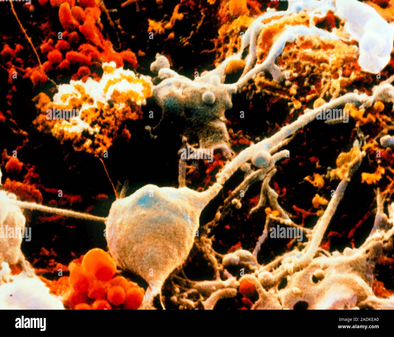 Brain cells. Coloured scanning electron micrograph showing neurones ...