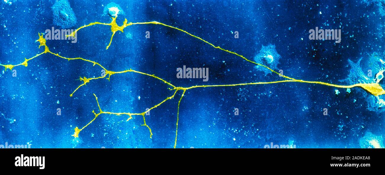 Neuron. Scanning electron micrograph of a nerve cell with a branching ...