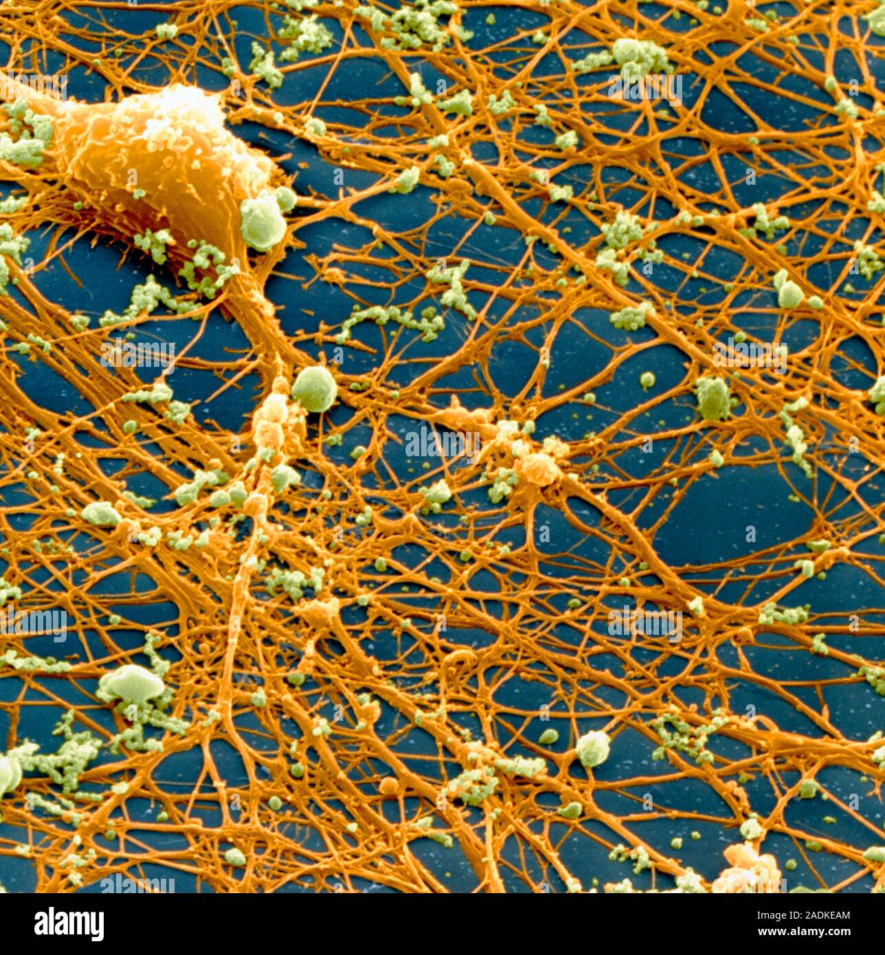 Brain cell culture. Coloured Scanning Electron Micrograph (SEM) of a ...