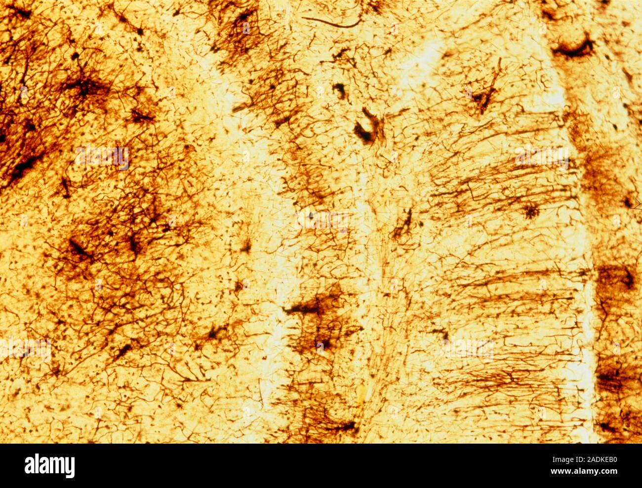 Cerebral cortex nerves. Light micrograph of a section through nerves in ...