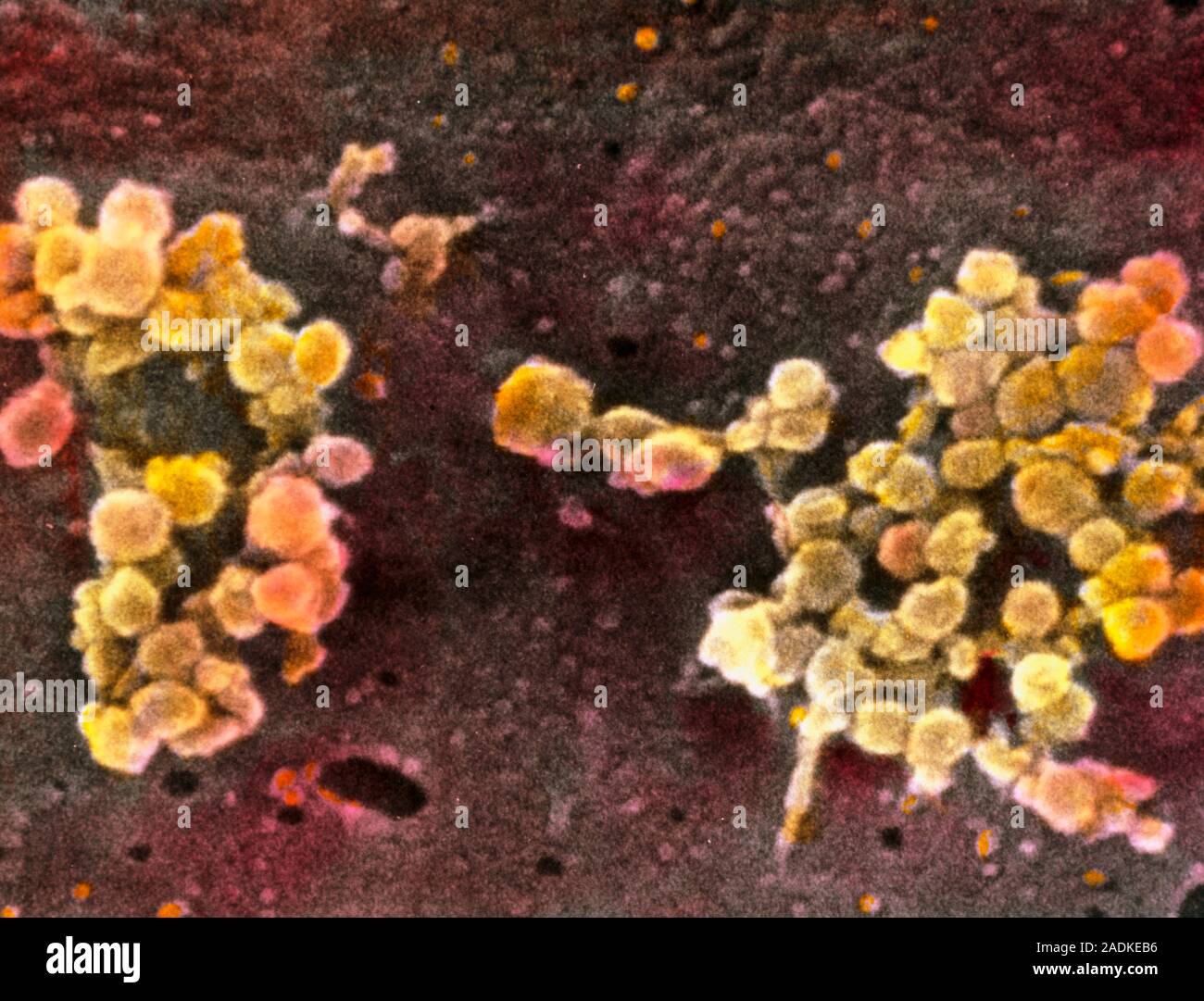 Synaptic vesicles. Coloured high resolution scanning electron ...