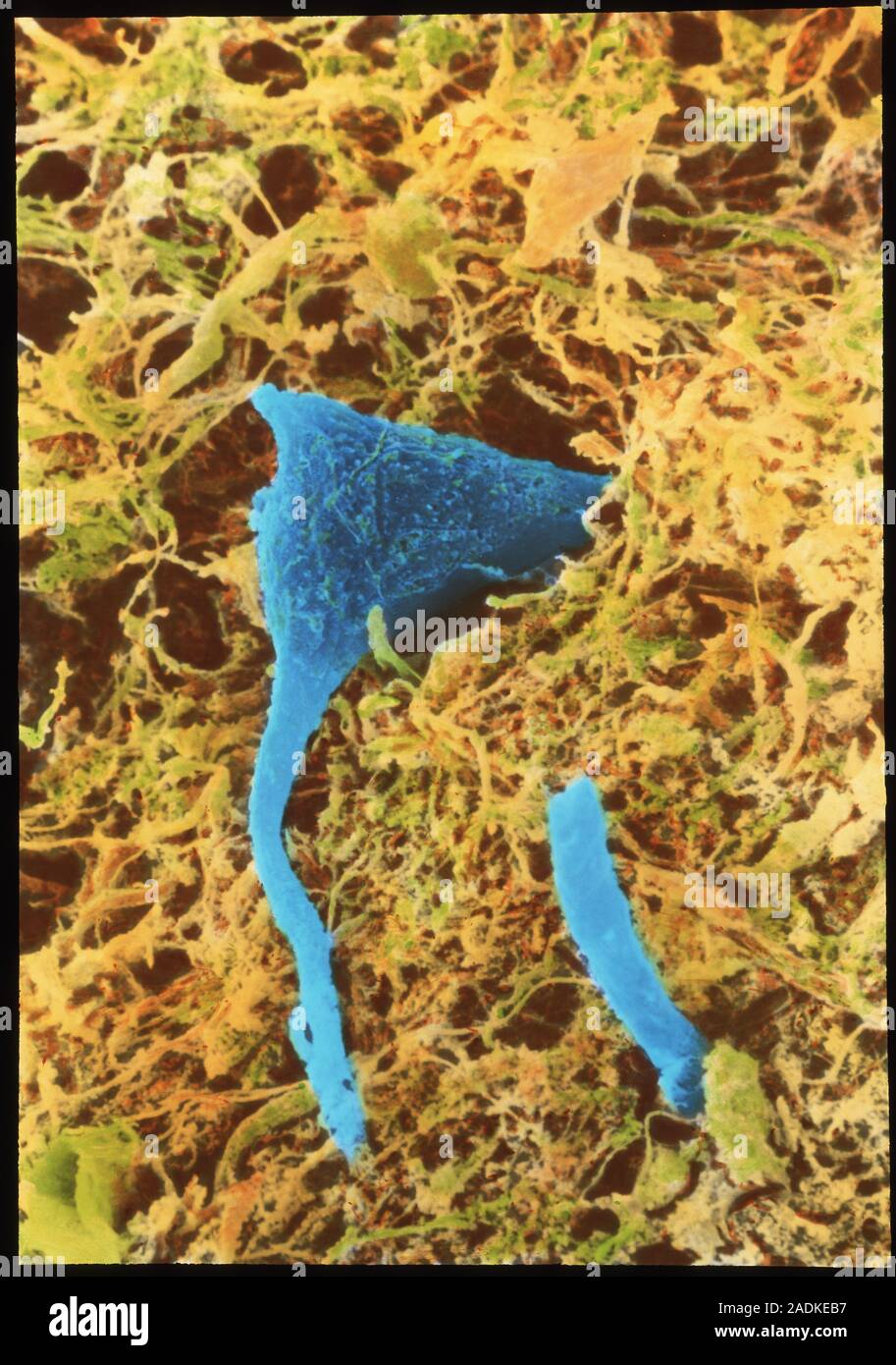 Nerve cell. Coloured scanning electron micrograph (SEM) of a section ...
