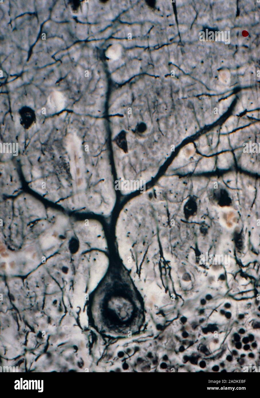 Purkinje cell. Light micrograph of a Purkinje nerve cell from the ...