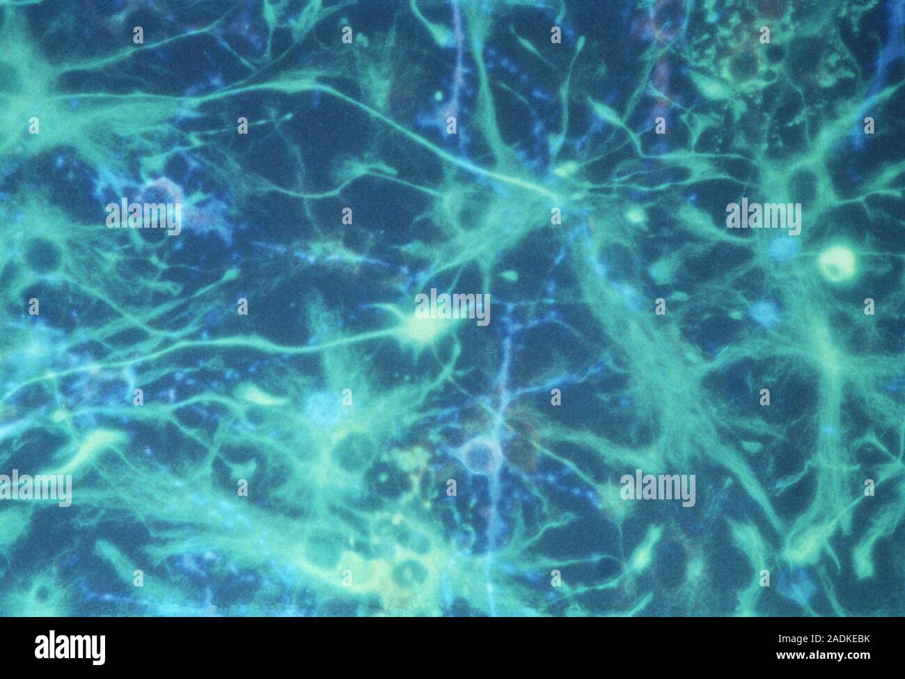 Brain cells. Fluorescence light micrograph of assorted brain cells. A ...
