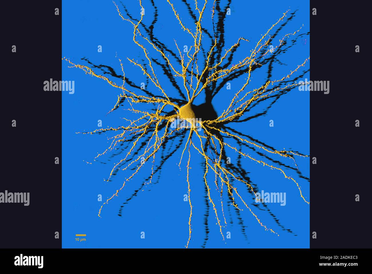 Nerve cell. Coloured computer image based on laser scanning microscope ...
