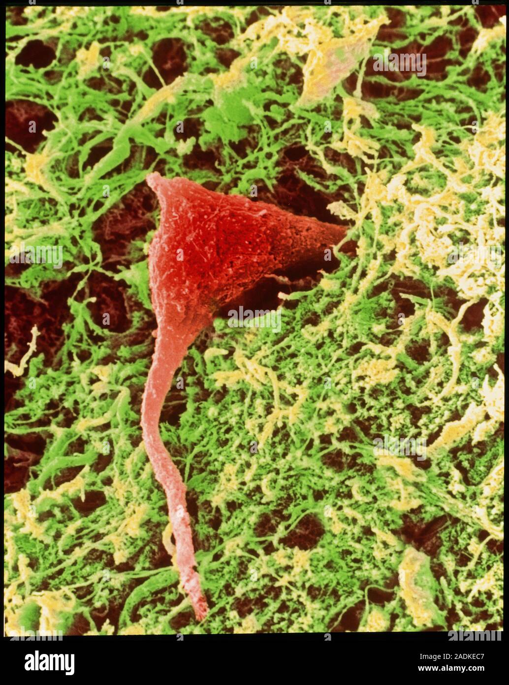 Nerve cell. Coloured scanning electron micrograph (SEM) of a section ...