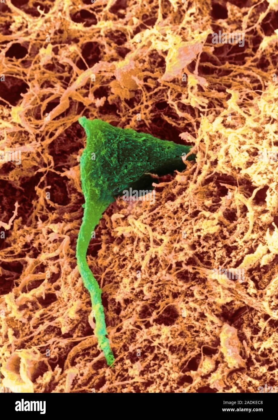Nerve cell. Coloured scanning electron micrograph (SEM) of a section ...