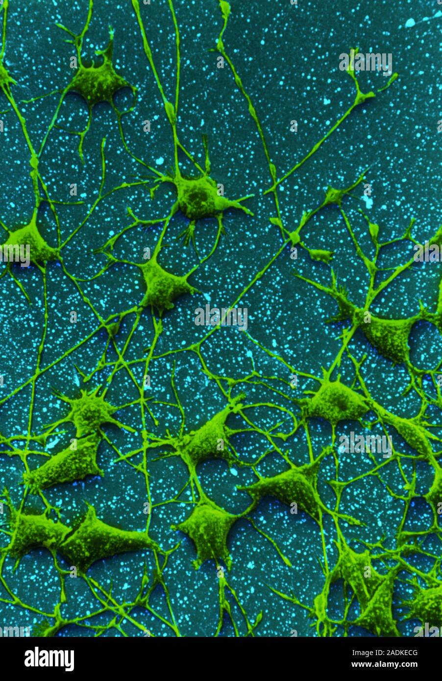 Nerve cells. Coloured scanning electron micrograph (SEM) of nerve cells ...