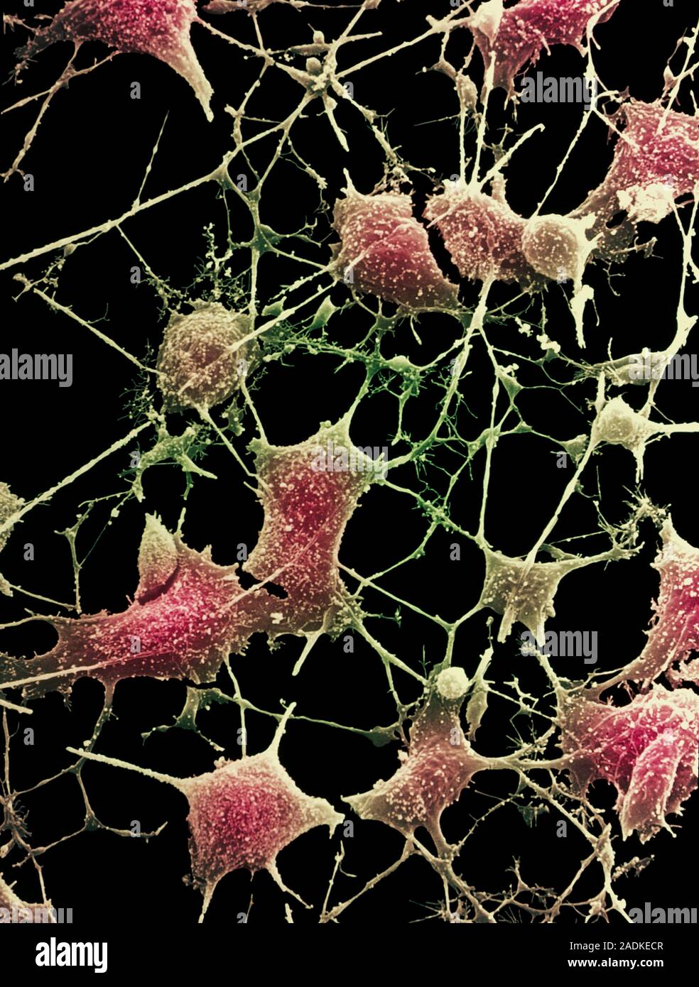 Nerve cells. Coloured scanning electron micrograph (SEM) of nerve cells ...