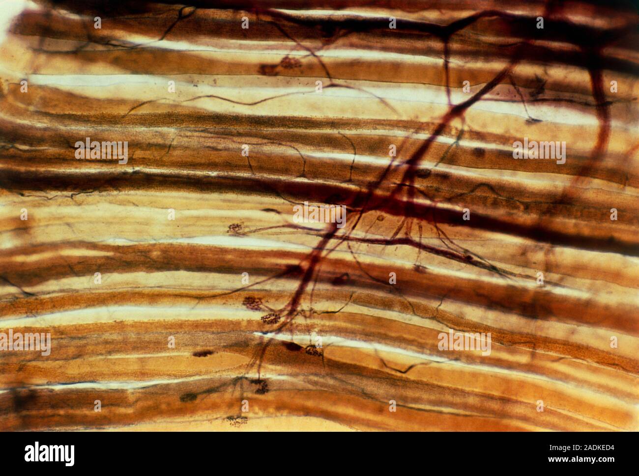 Nerve endings in muscle. Light micrograph of motor neuron end plates ...