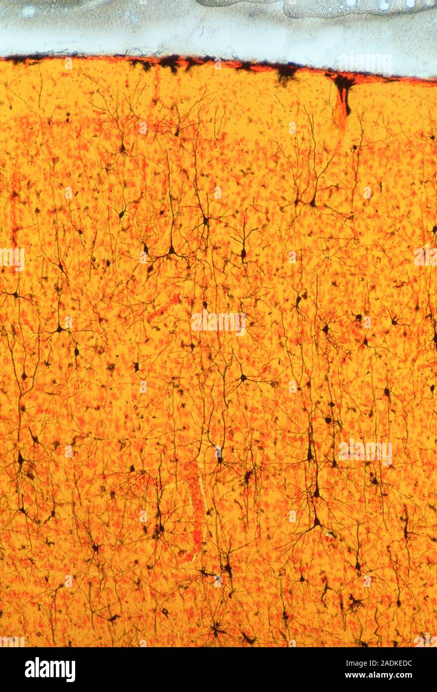 Nerve cells. Light micrograph of a section through nerve cells ...