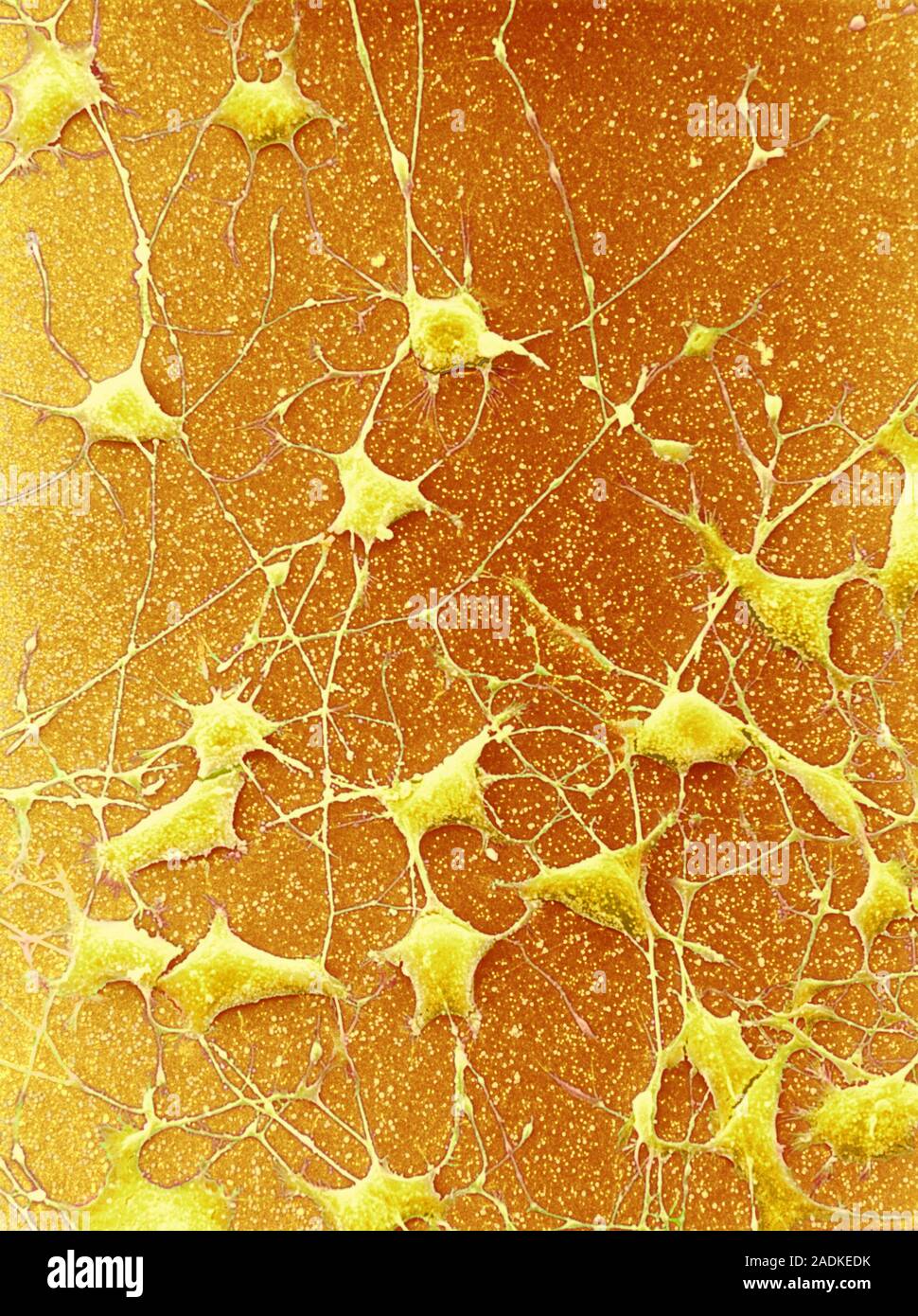 Nerve cells. Coloured scanning electron micrograph (SEM) of nerve cells ...