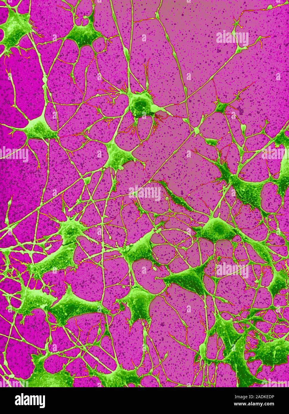 Nerve cells. Coloured scanning electron micrograph (SEM) of nerve cells ...