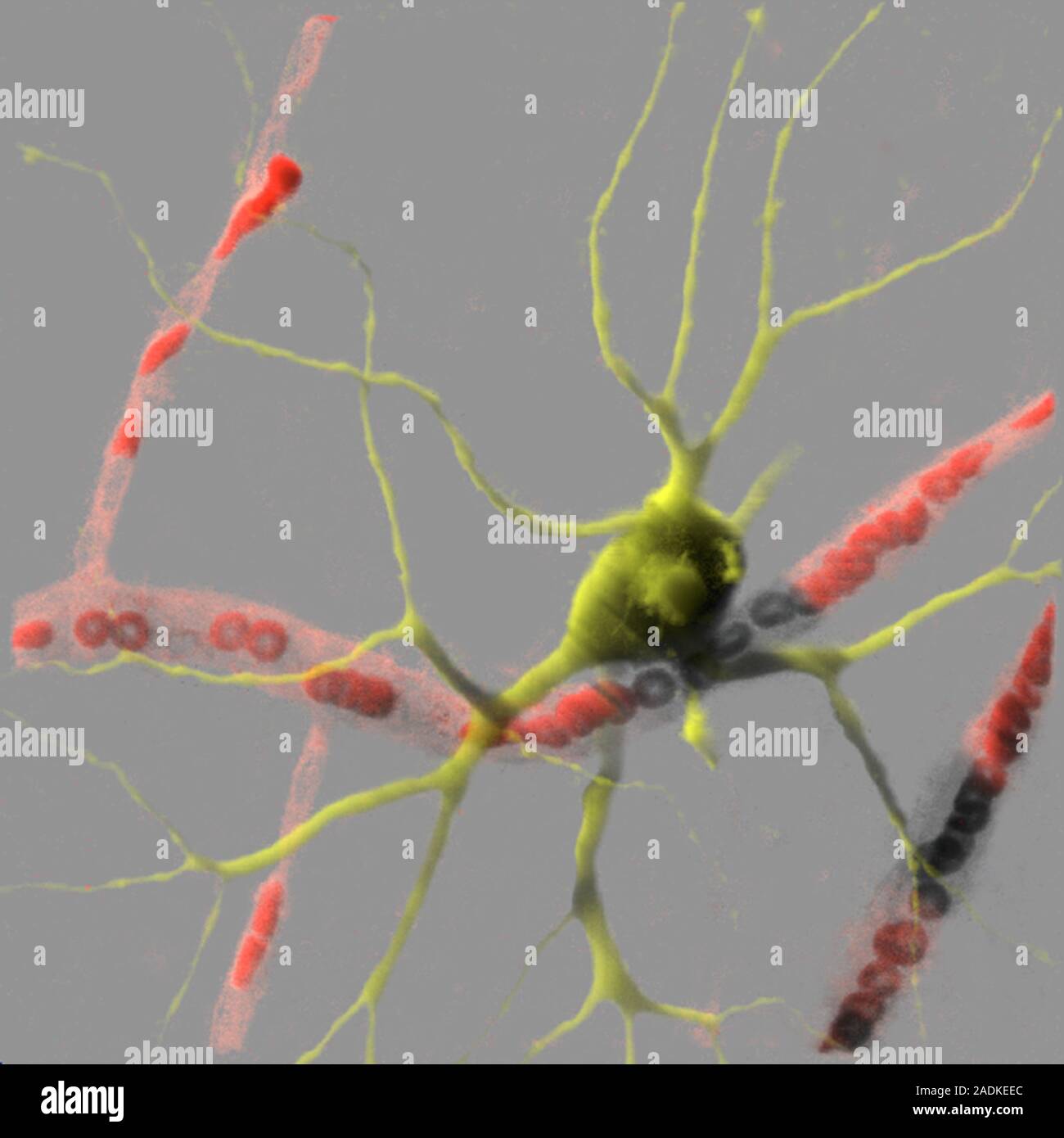 Nerve cell. Coloured confocal light micrograph of a nerve cell (neuron ...