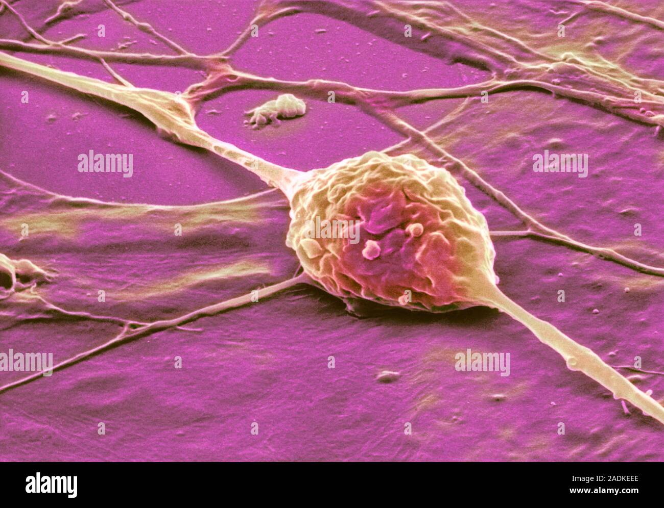 Granule nerve cell. Coloured scanning electron micrograph (SEM) of a ... Granule nerve cell. Coloured scanning electron micrograph (SEM) of a ...