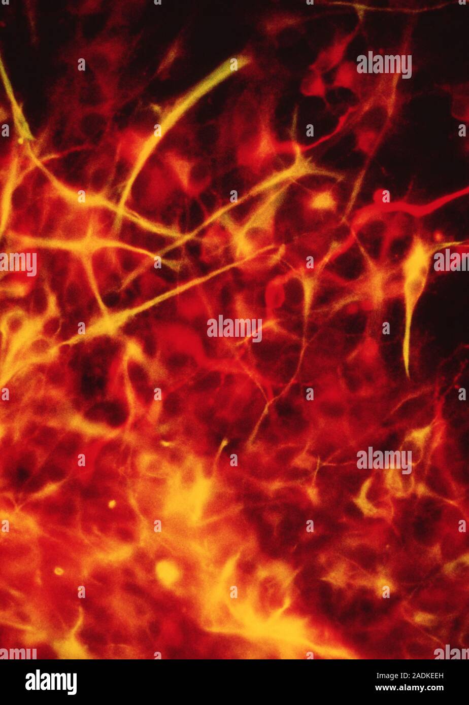 Nerve cells. Immunofluorescent light micrograph of nerve cells (neurons ...