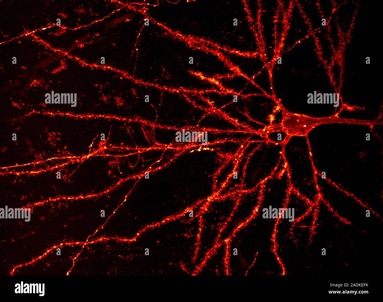 Nerve cell. Confocal light micrograph of a neurone (nerve cell) from a ...
