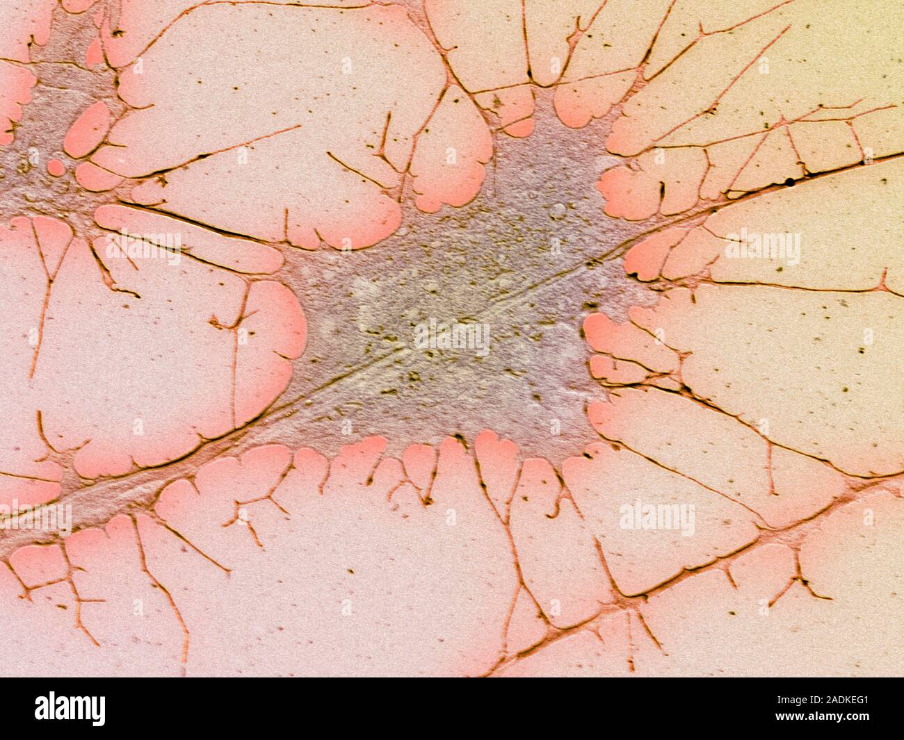 Nervous Tissue New Insights Into ADAMTS Metalloproteases In The