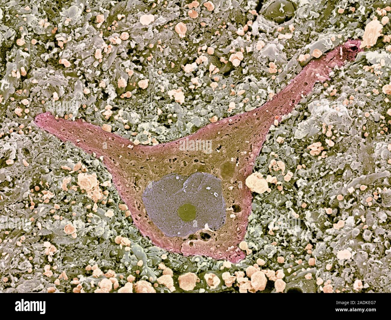 Neuron. Coloured scanning electron micrograph (SEM) of a freeze ...