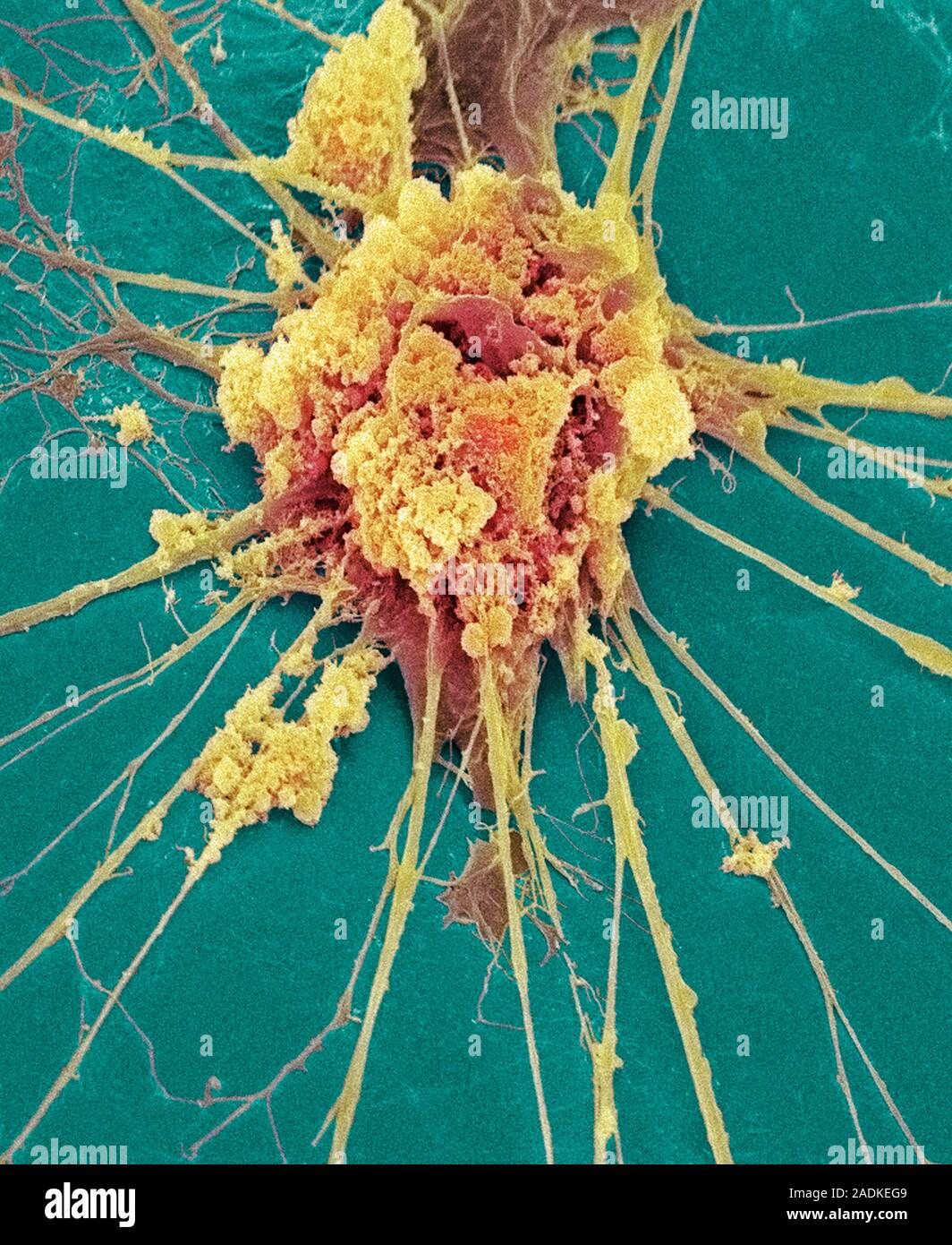 Nerve cell. Coloured scanning electron micrograph (SEM) of a neuron ...