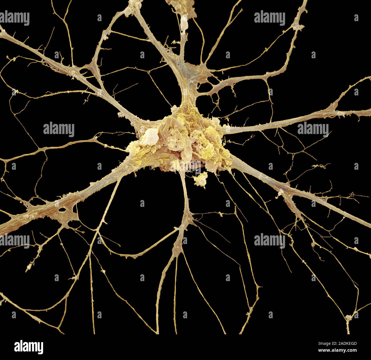 Nerve cell. Coloured scanning electron micrograph (SEM) of a neuron ...