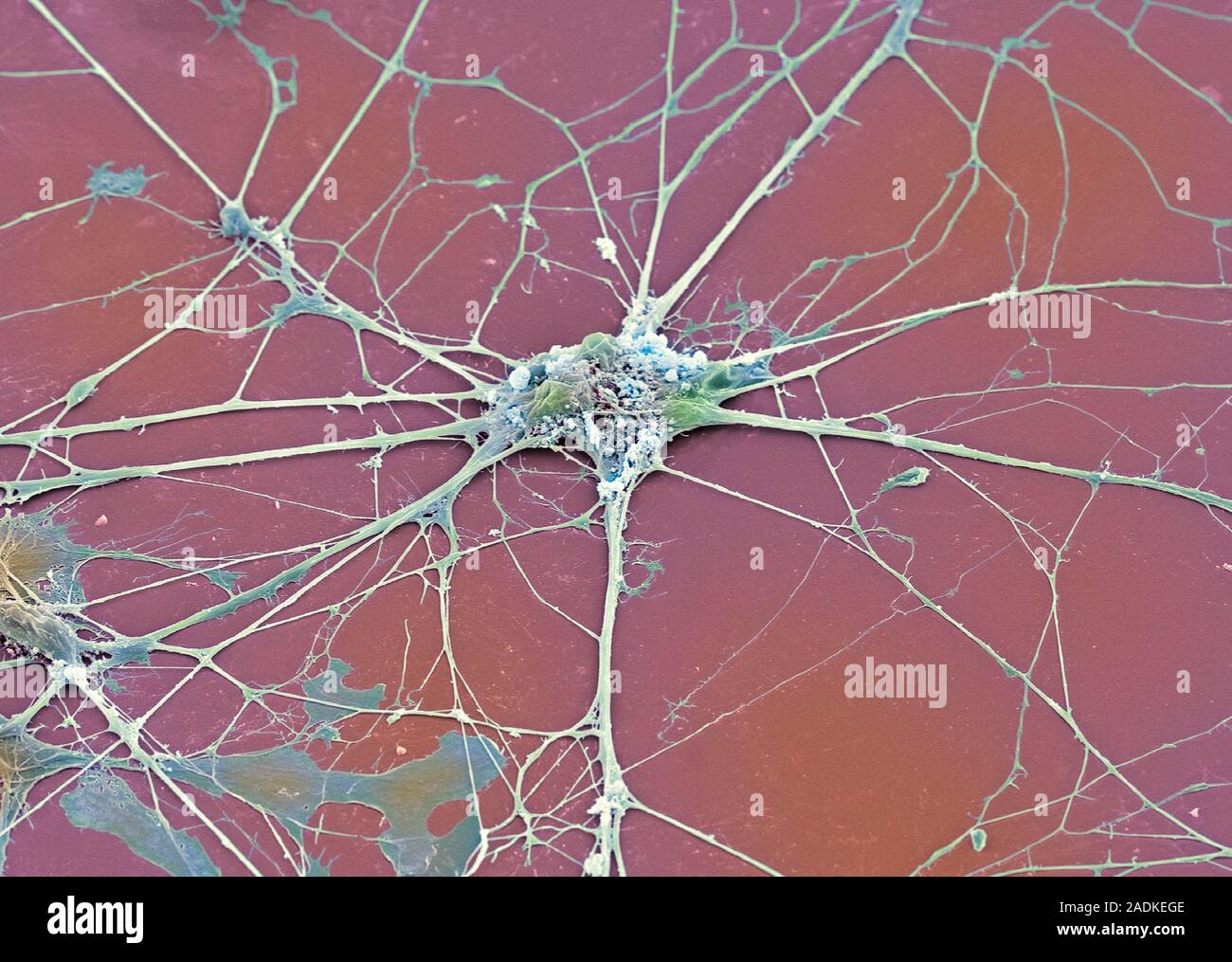 Nerve cell. Coloured scanning electron micrograph (SEM) of a neuron ...