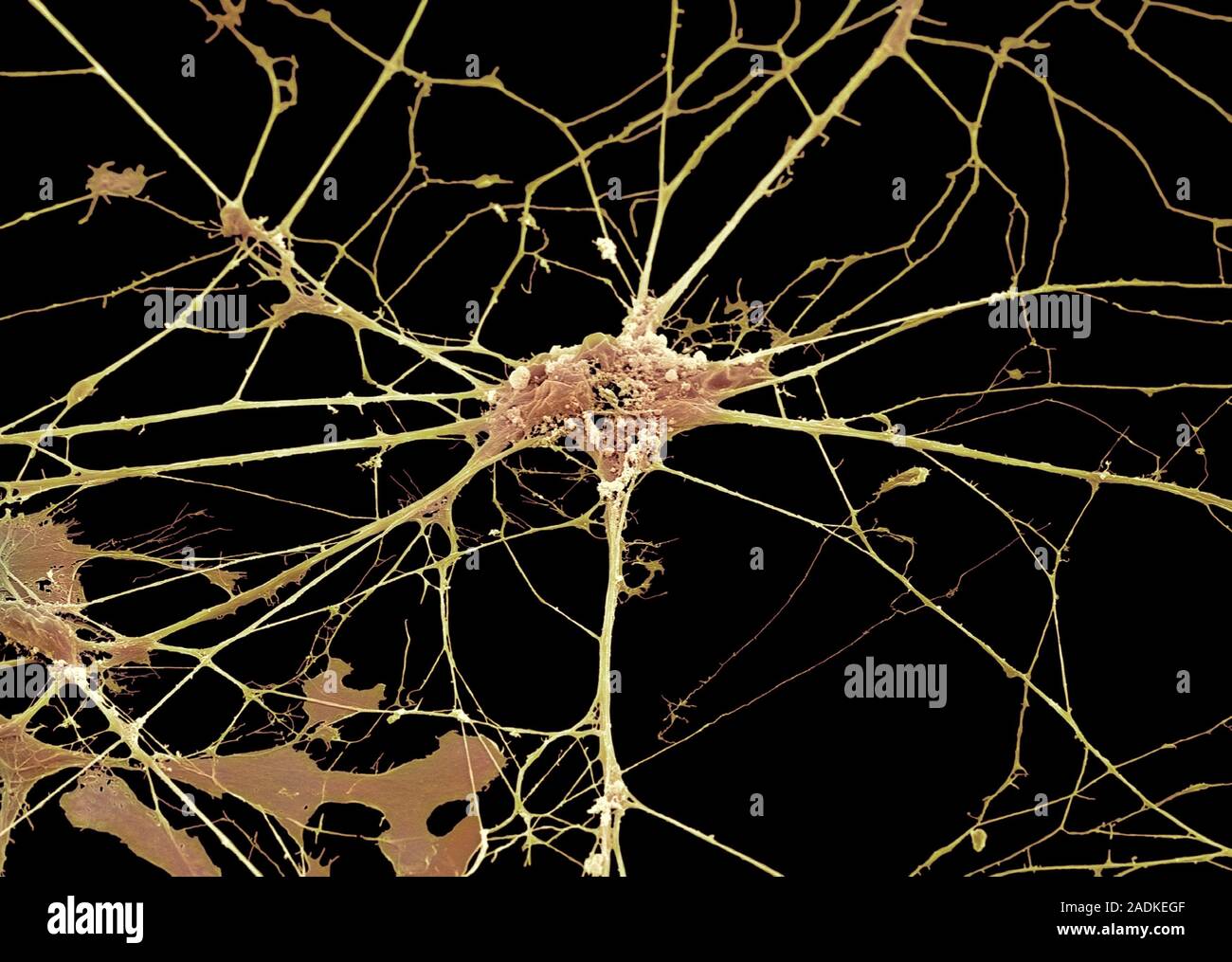 Nerve cell. Coloured scanning electron micrograph (SEM) of a neuron ...