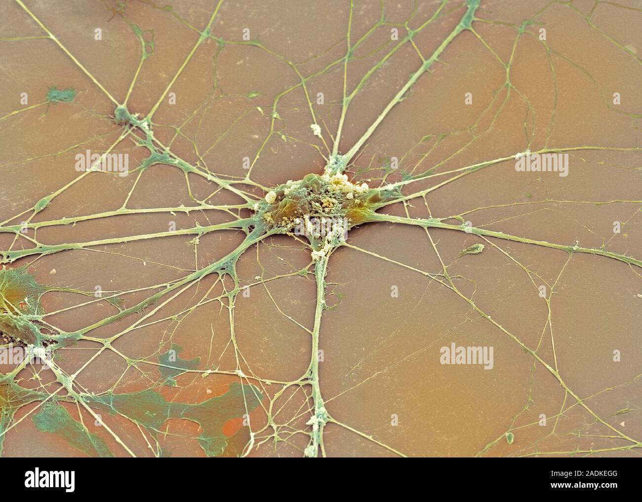Nerve cell. Coloured scanning electron micrograph (SEM) of a neuron ... Nerve cell. Coloured scanning electron micrograph (SEM) of a neuron ...