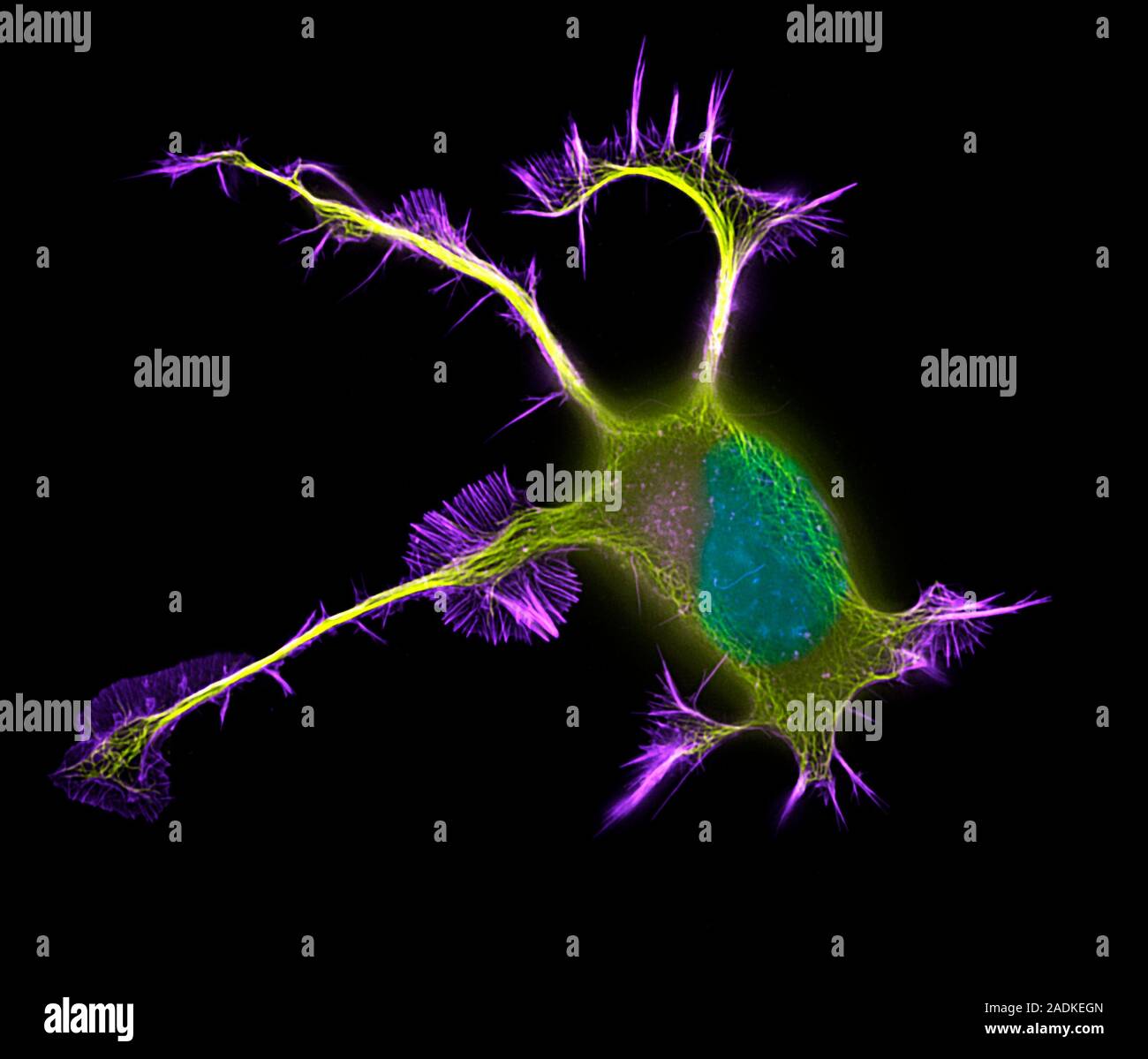 Nerve cell growth. Fluorescent light micrograph of a PC12 cell ...