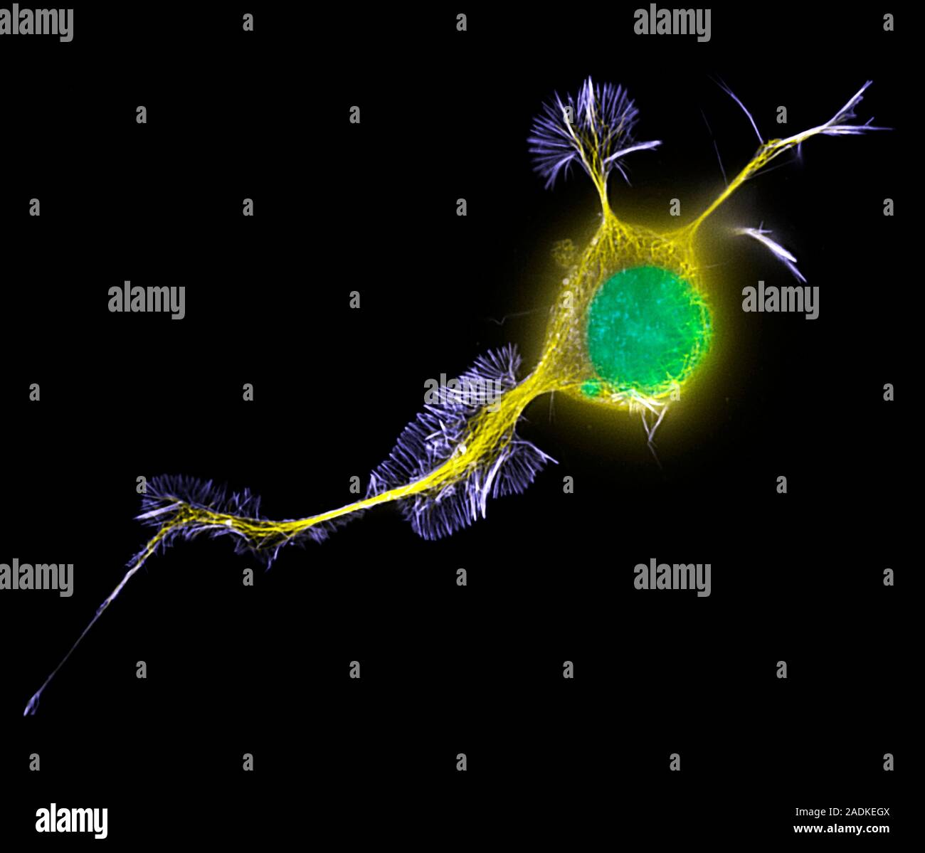 Nerve cell growth. Fluorescent light micrograph of a PC12 cell ...