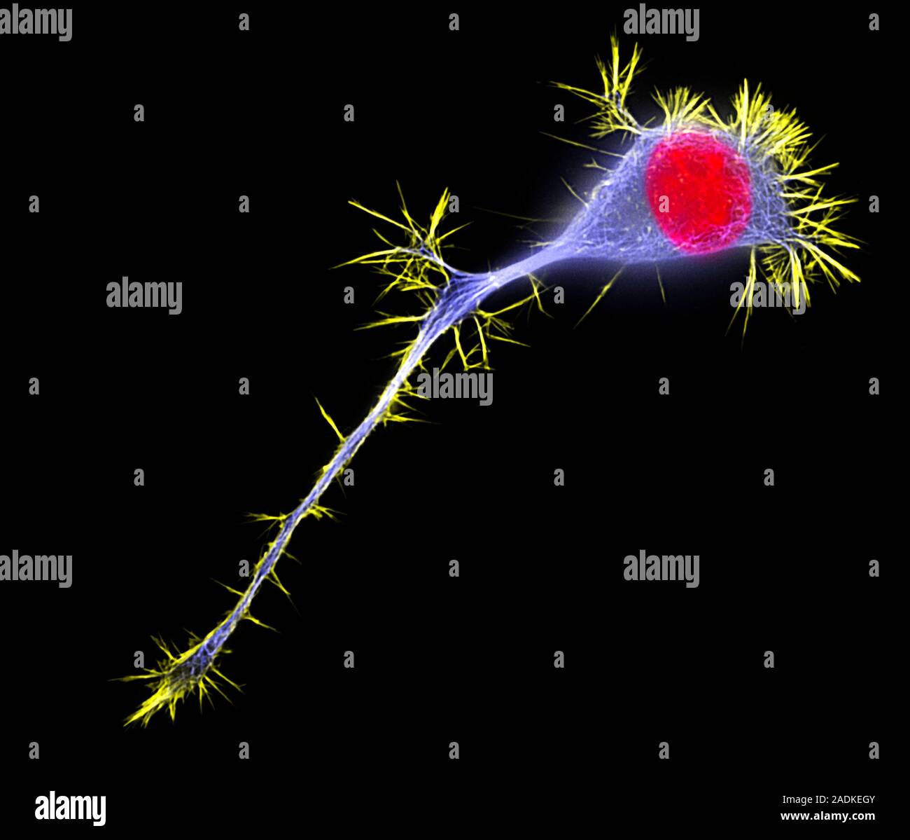 Nerve cell growth. Fluorescent light micrograph of a PC12 cell ...