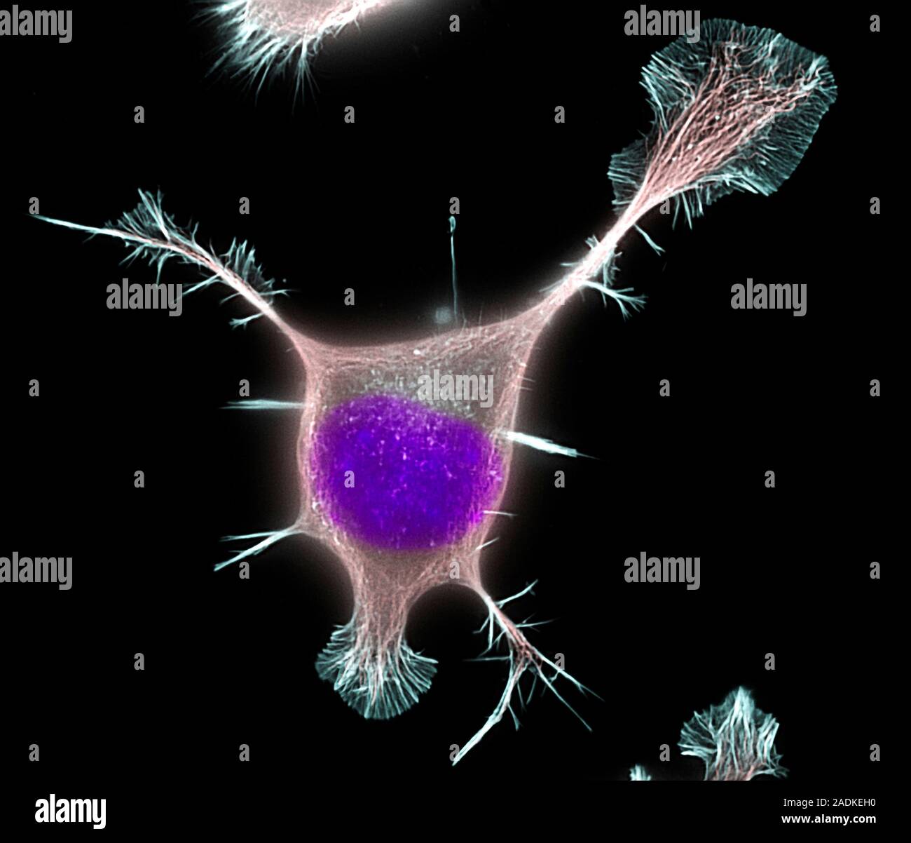 Nerve cell growth. Fluorescent light micrograph of a PC12 cell ...