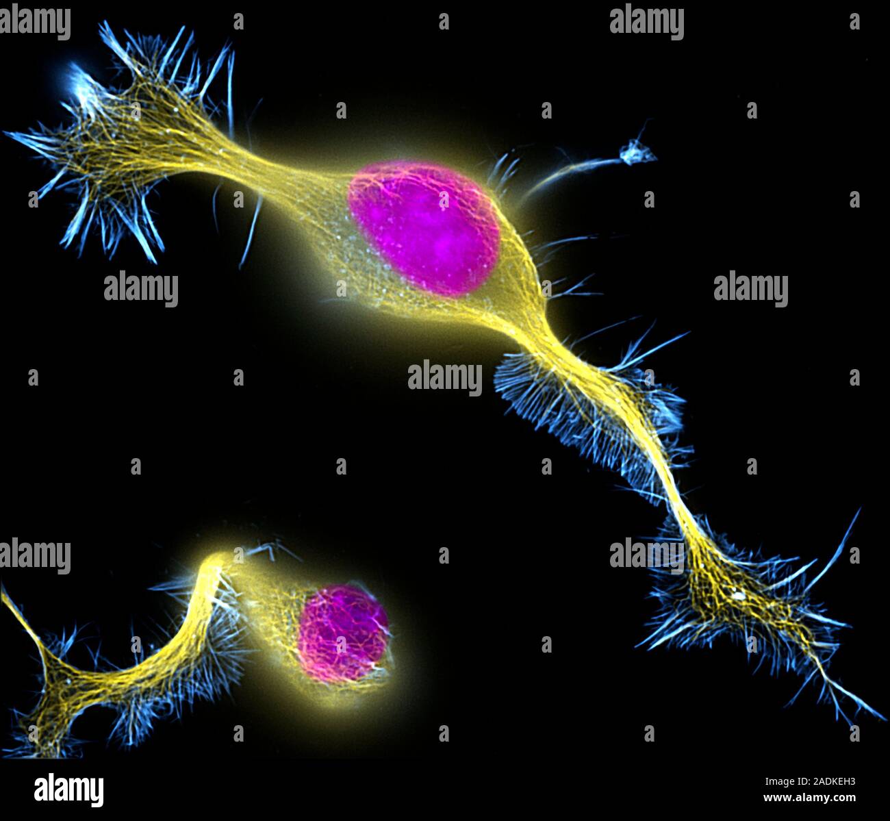 Nerve cell growth. Fluorescent light micrograph of PC12 cells following ...