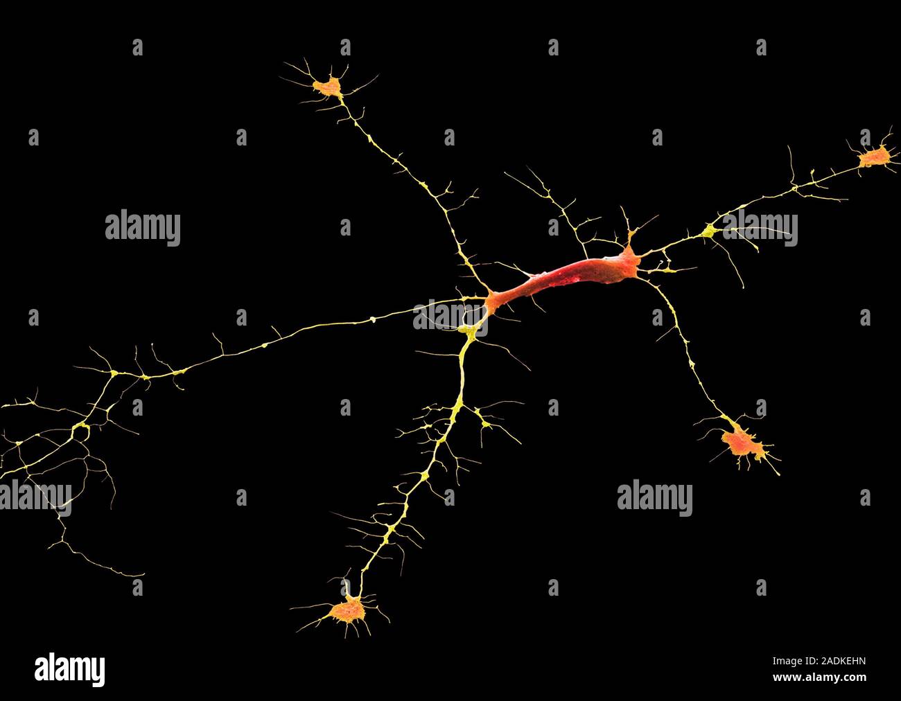 Nerve cell. Coloured scanning electron micrograph (SEM) of a nerve cell ...
