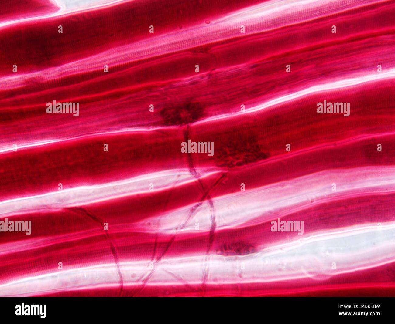 Muscle nerve endings. Coloured light micrograph (LM) of two motor ...