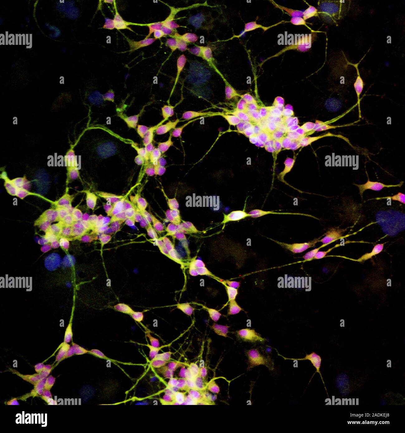 Nerve cell growth. Light micrograph of nerve cells (neurons) with ...