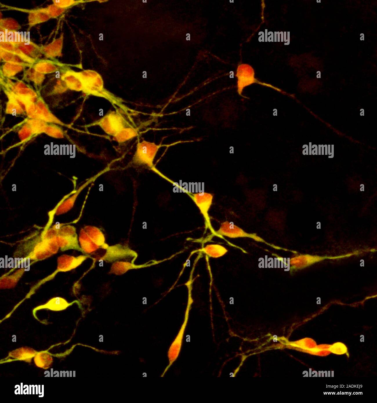 Nerve cell growth. Light micrograph of nerve cells (neurons) with ...