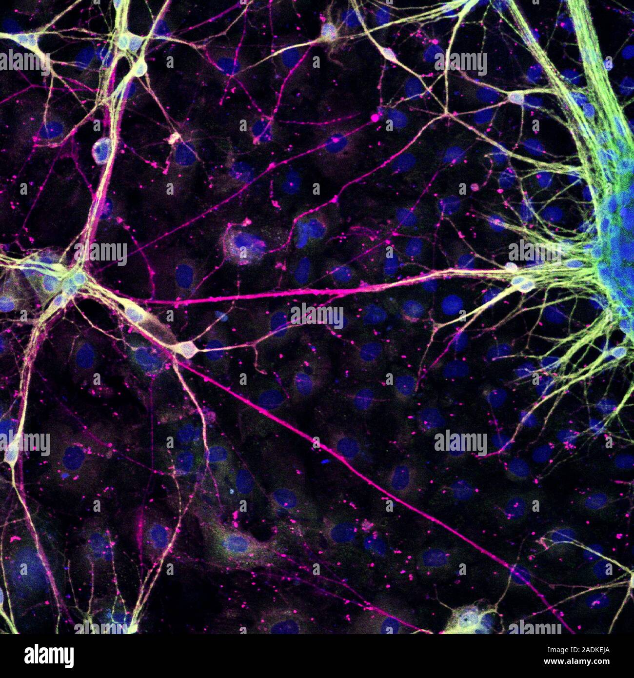 Nerve cell growth. Light micrograph of nerve cells (neurons) with ...