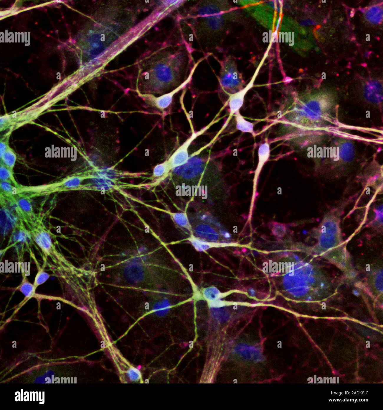Nerve cell growth. Light micrograph of nerve cells (neurons) with ...