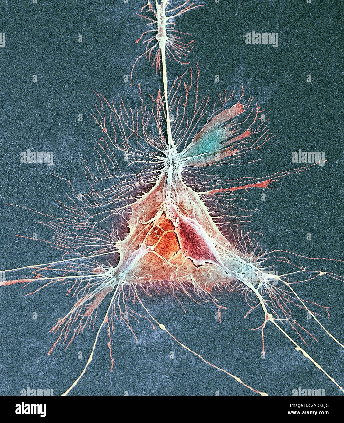 Nerve support cell. Coloured scanning electron micrograph (SEM) of an ... Nerve support cell. Coloured scanning electron micrograph (SEM) of an ...