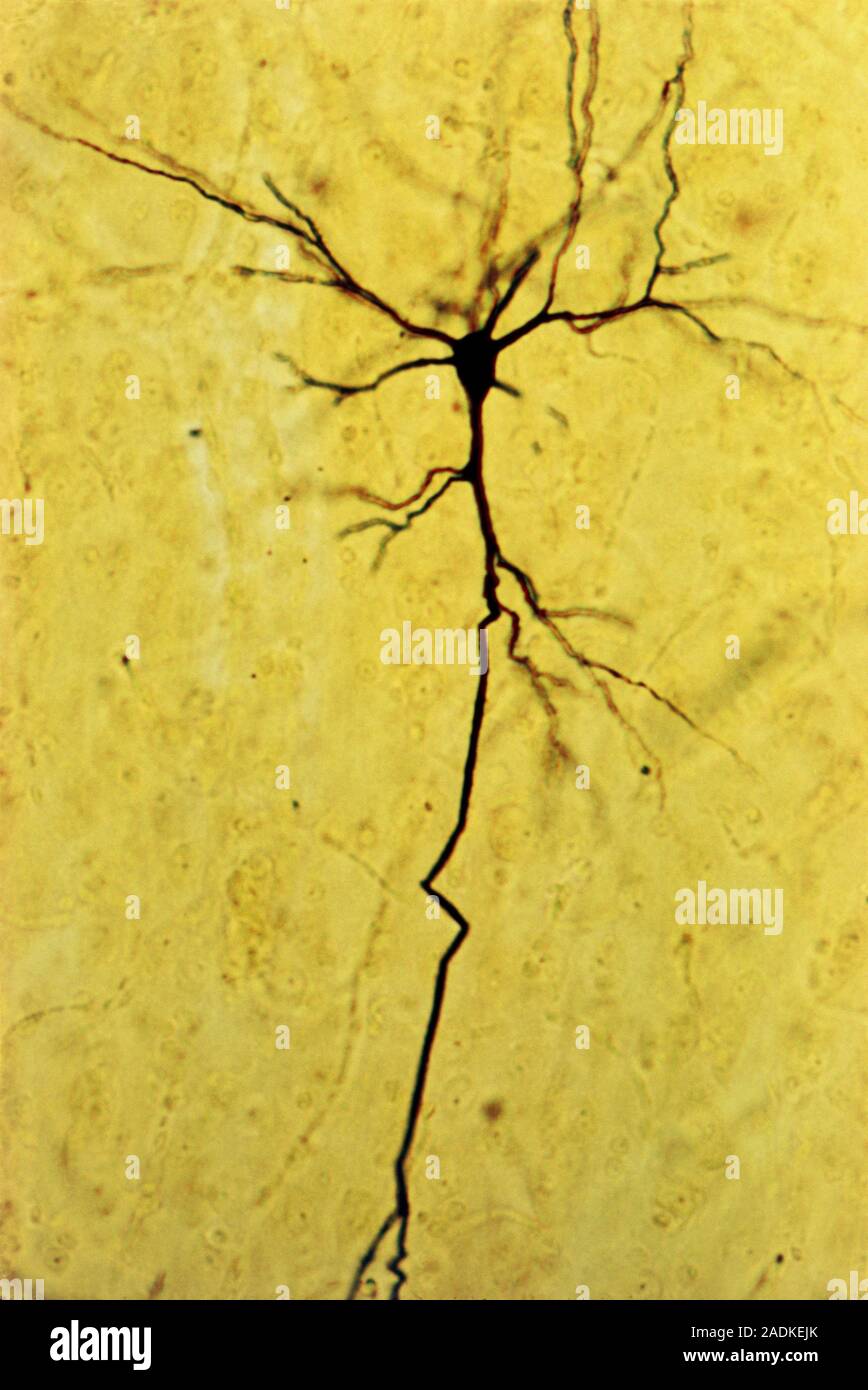 Nerve cell. Light micrograph of a nerve cell, or neuron. Neurons are ...