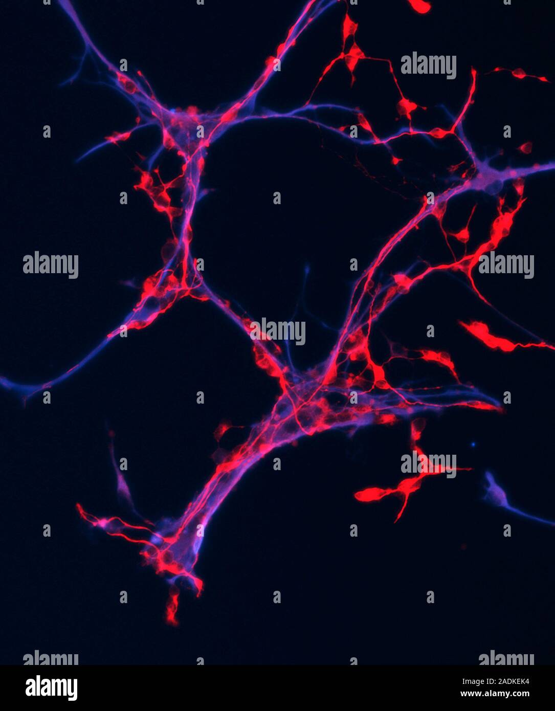Nerve cell growth. Fluorescent light micrograph of neurons (nerve cells ...