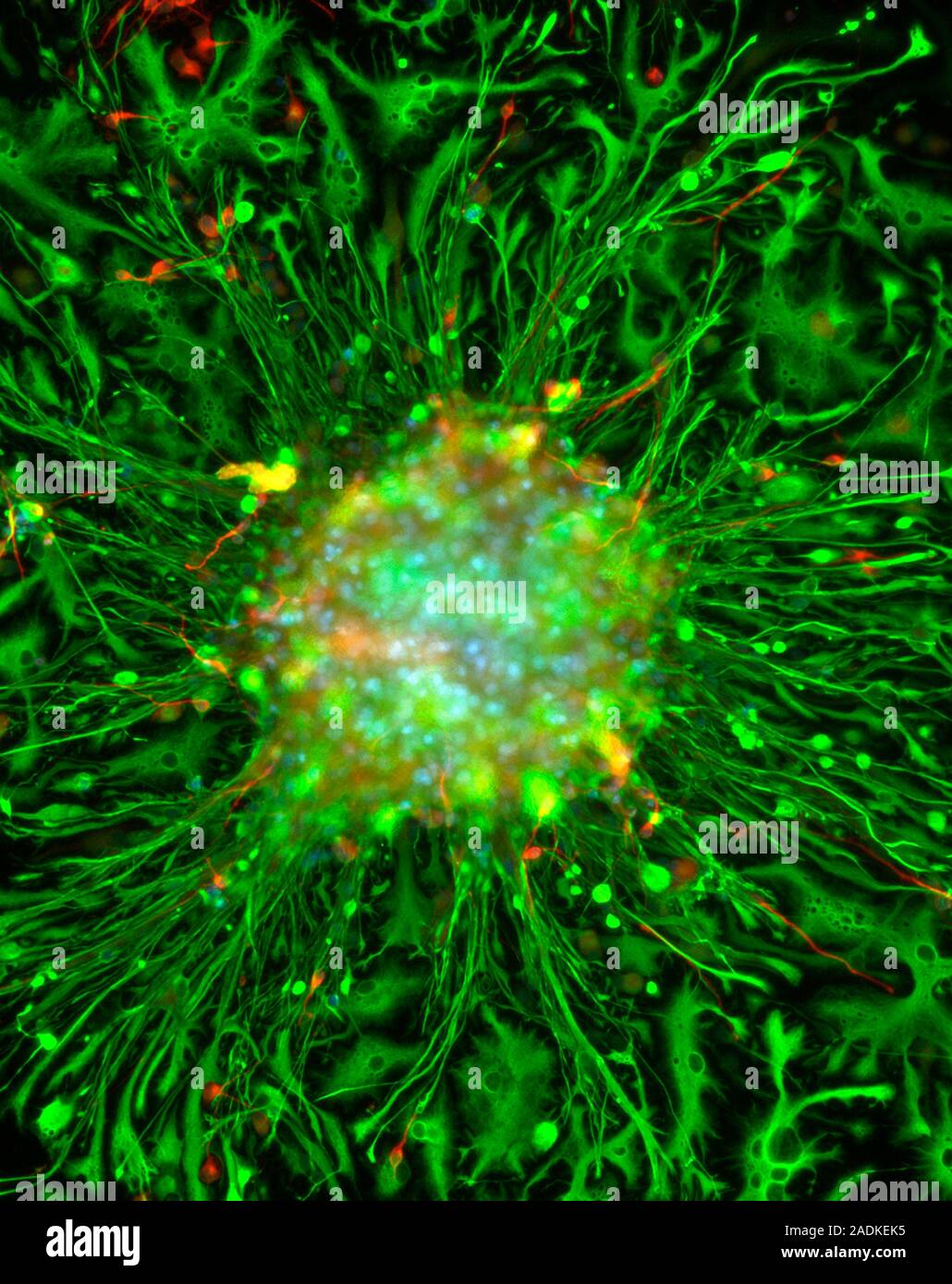Neurosphere culture. Fluorescent light microscope of a group of neural ...