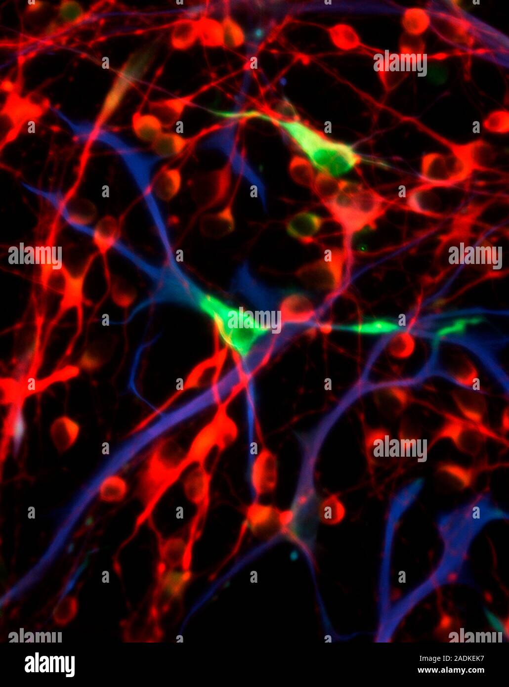 Nerve cells. Fluorescent light micrograph of neurons (nerve cells, red ...