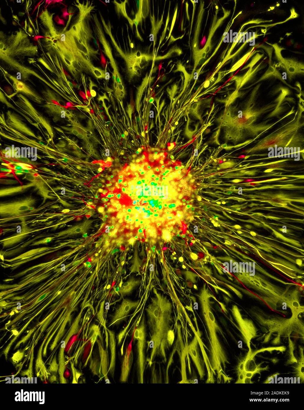 Neurosphere culture. Fluorescent light microscope of a group of neural ...