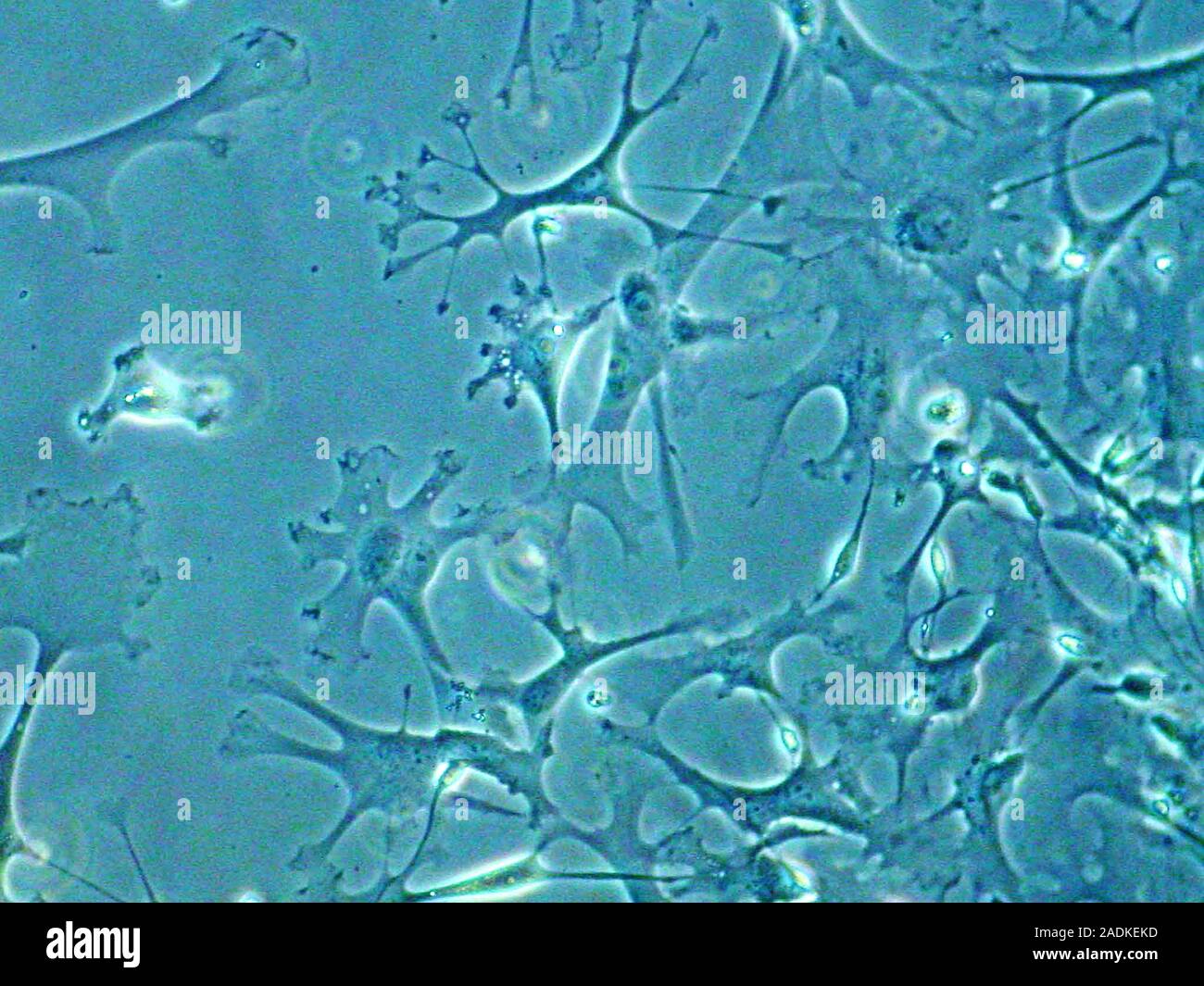Astrocyte nerve cells. Light micrograph of astrocyte cells from a human ...